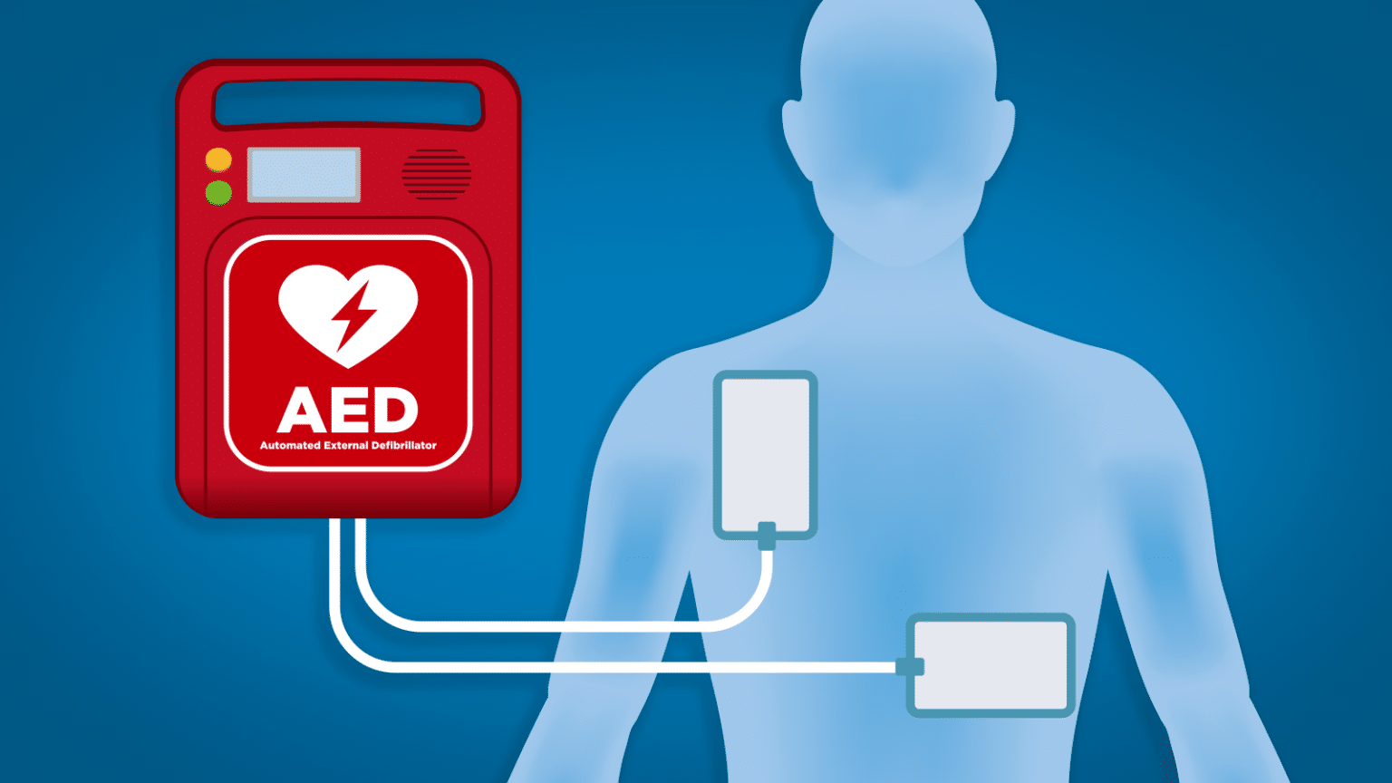 Automated External Defibrillator Explained: How AEDs Work & When to Use ...