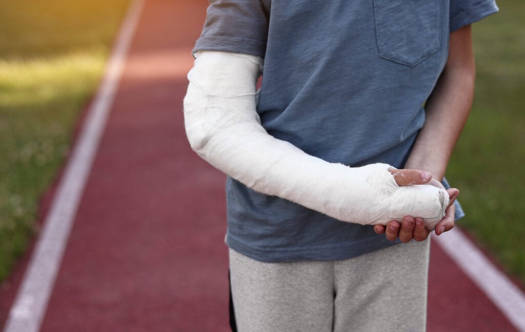 Treating Fractures: Your Comprehensive First Aid Guide