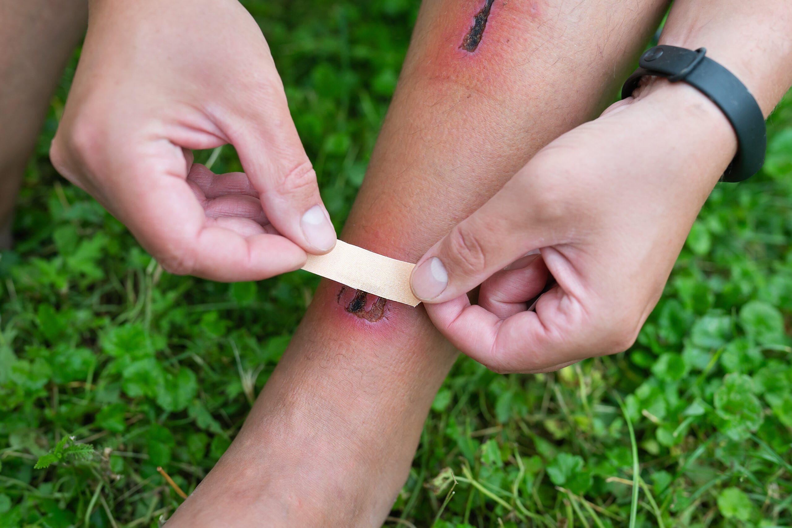 Providing First Aid For A Stab Wound Victim FirstAidPro Providing First Aid For A Stab Wound Victim FirstAidPro