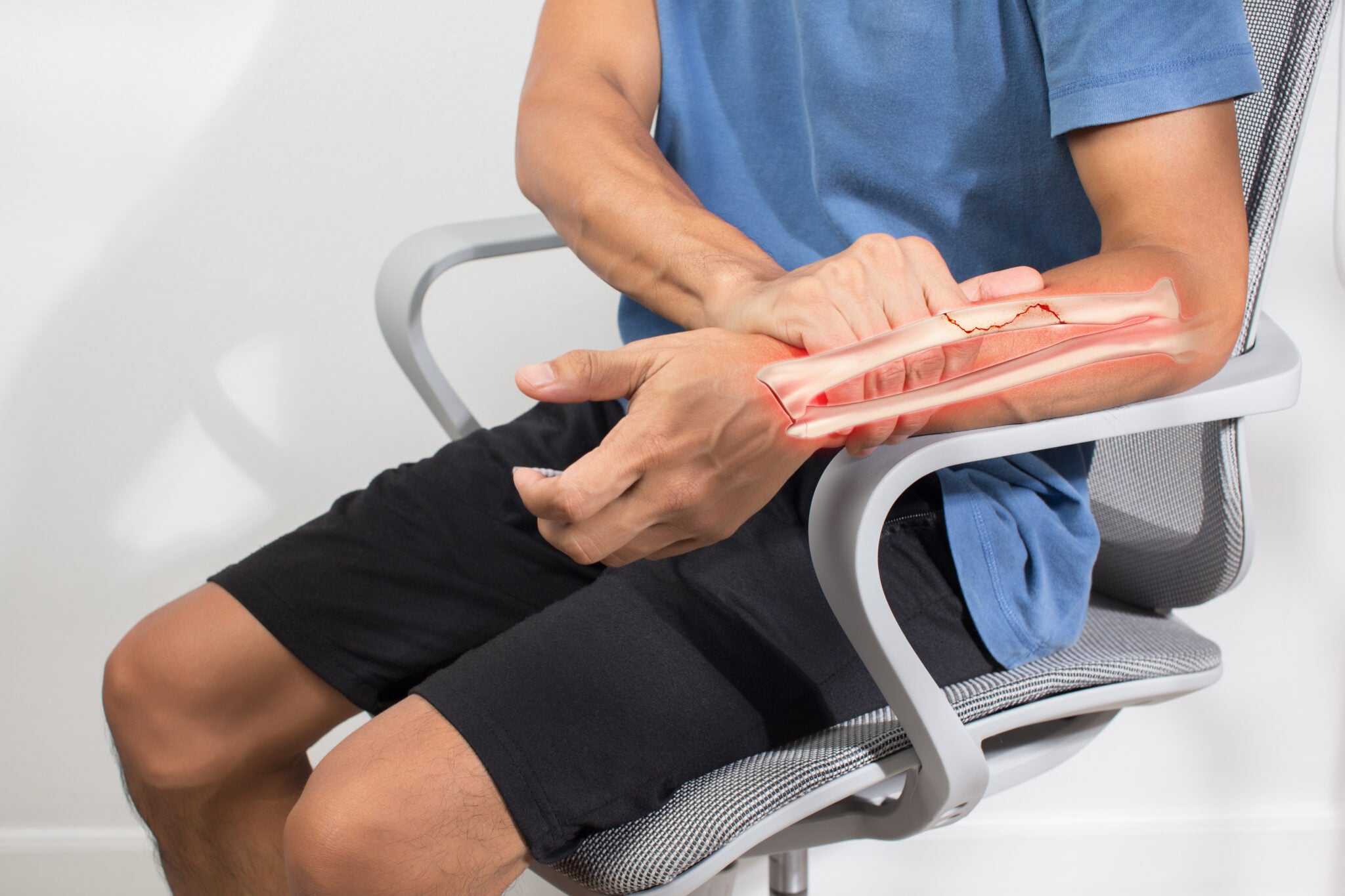 Broken Bones: Comprehensive First Aid Guide
