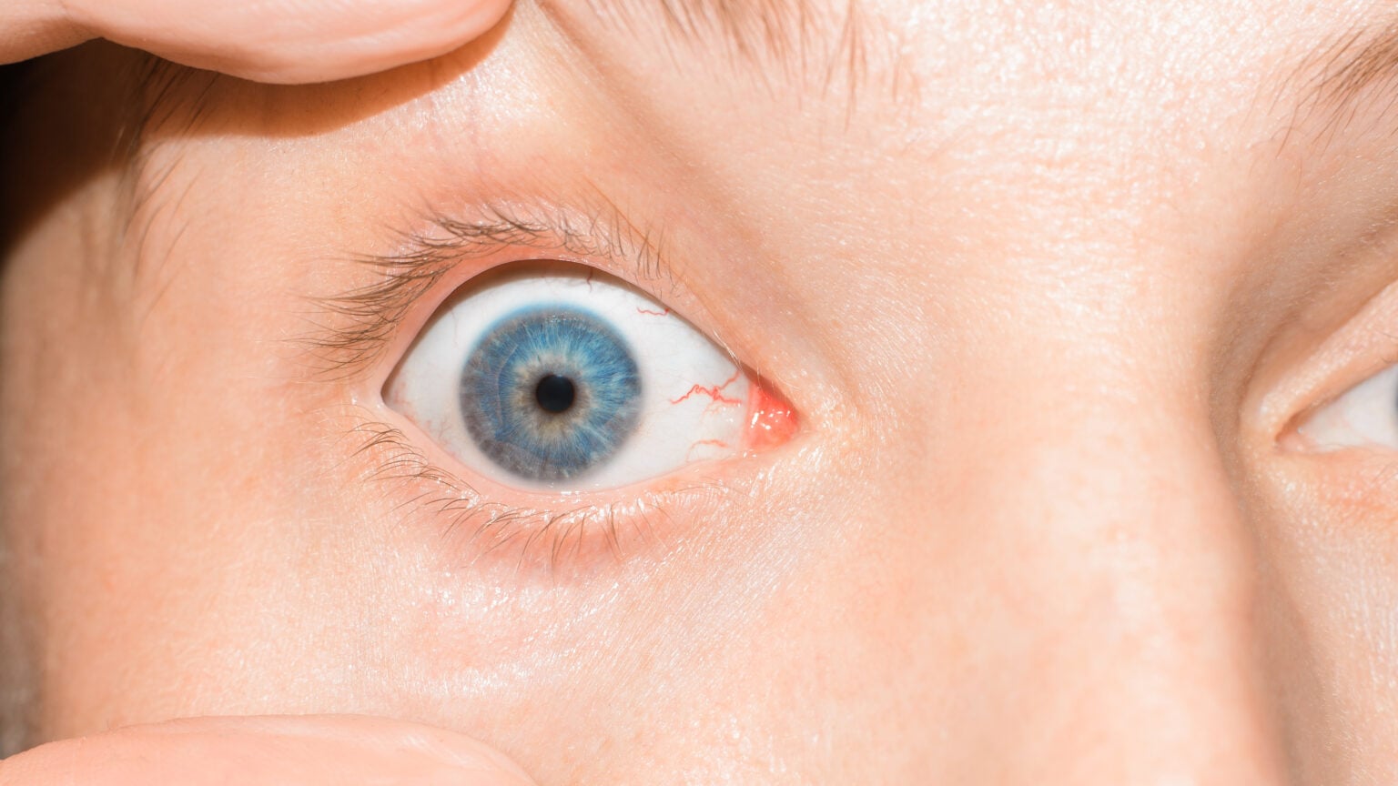 Kids' Eye Injury First Aid Tips for Effective Treatment