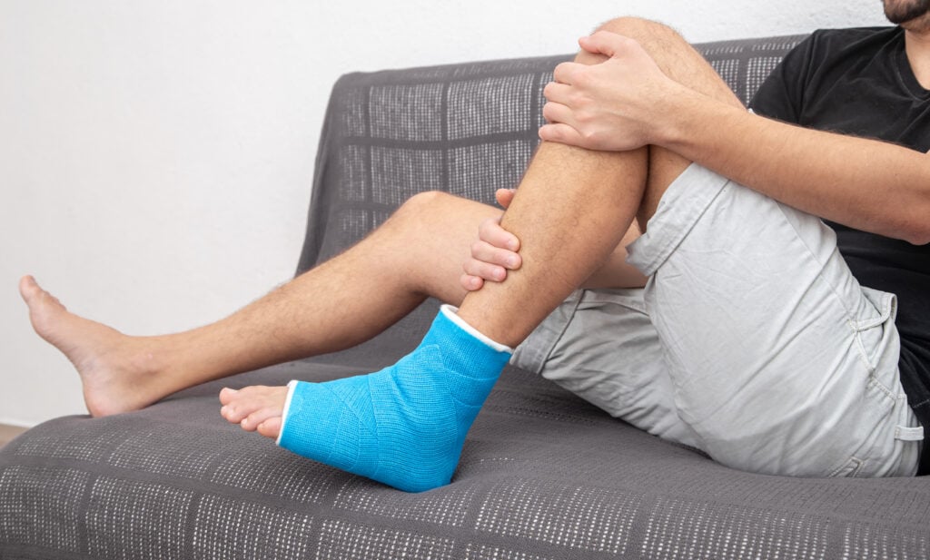 Broken Bones: Comprehensive First Aid Guide