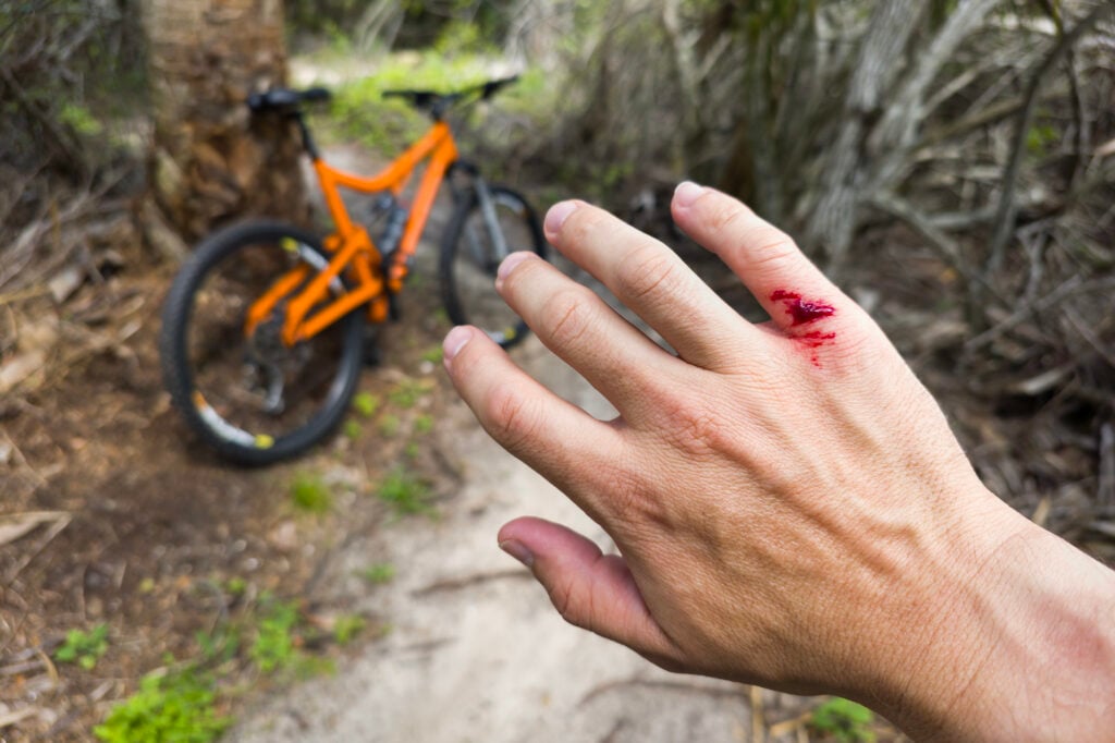 Managing a Deep Cut: A How-To First Aid Guide for Injuries