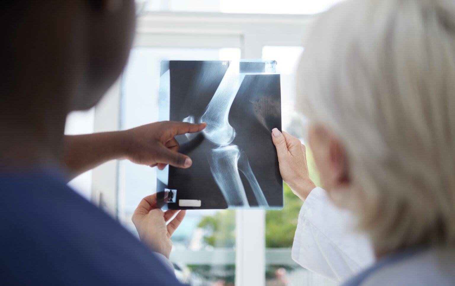 Treating Fractures: Your Comprehensive First Aid Guide